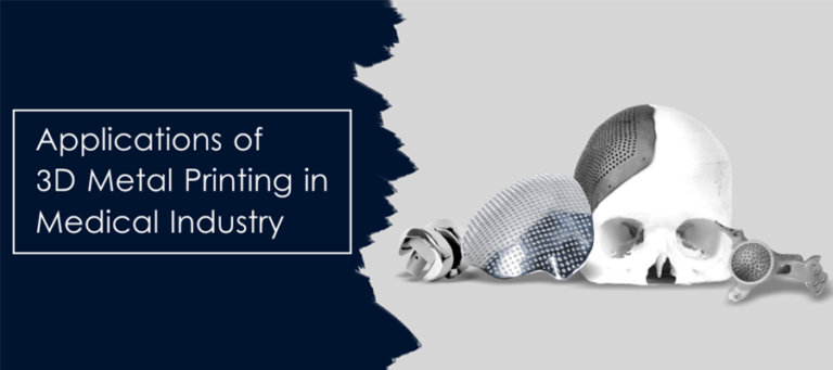 3D Printing Metals for Orthopedic Implants Application